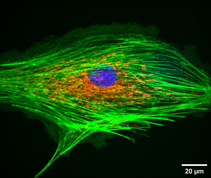 Spinning Disk Confocal Microscope | SIMTRUM Photonics