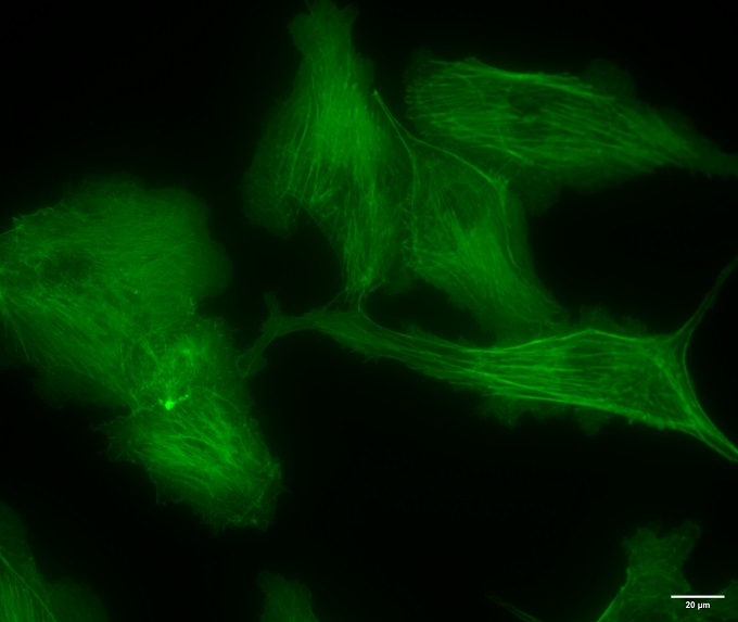 Spinning Disk Confocal Microscope | SIMTRUM Photonics