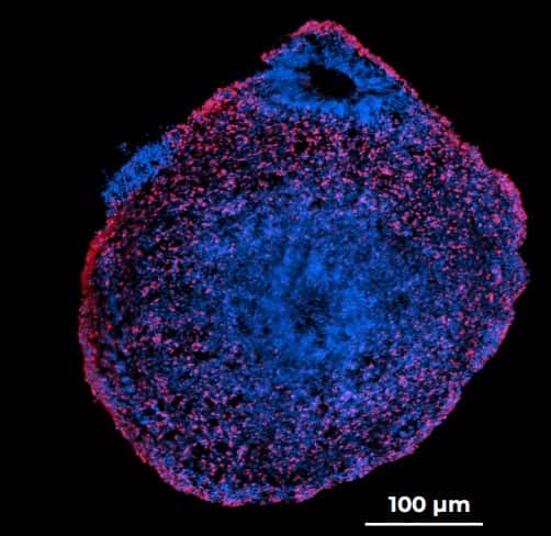 Spinning Disk Confocal Microscope | SIMTRUM Photonics